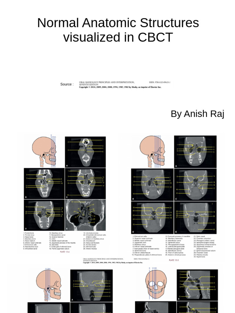Normal Anatomy CBCT | PDF