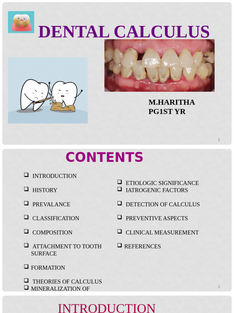 Understanding Dental Calculus: A Comprehensive Guide | PDF ...
