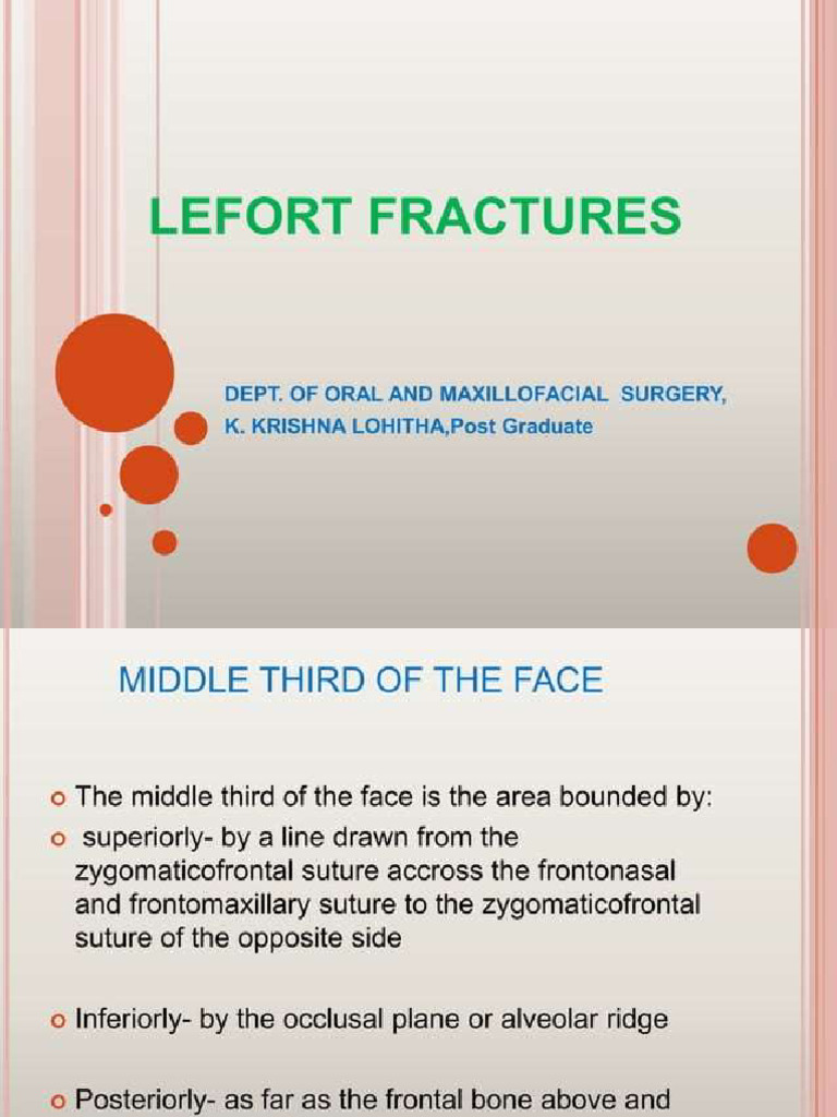 Le Fort Fracture | PDF