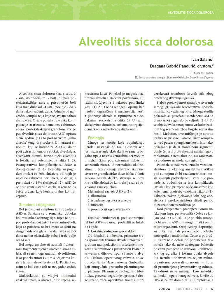 Alveolitis Sicca | PDF