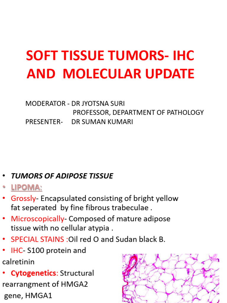 Seminar Soft Tissue Tumors | PDF | Cell Biology | Anatomy