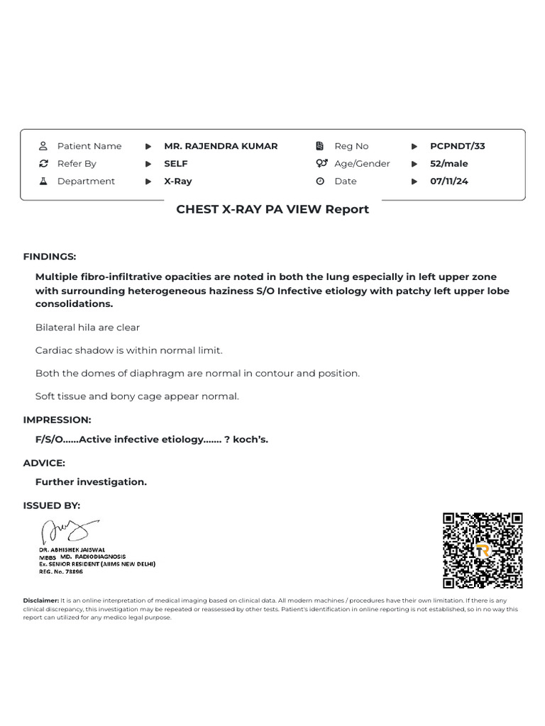 Chest X-Ray Report: Infective Findings | PDF