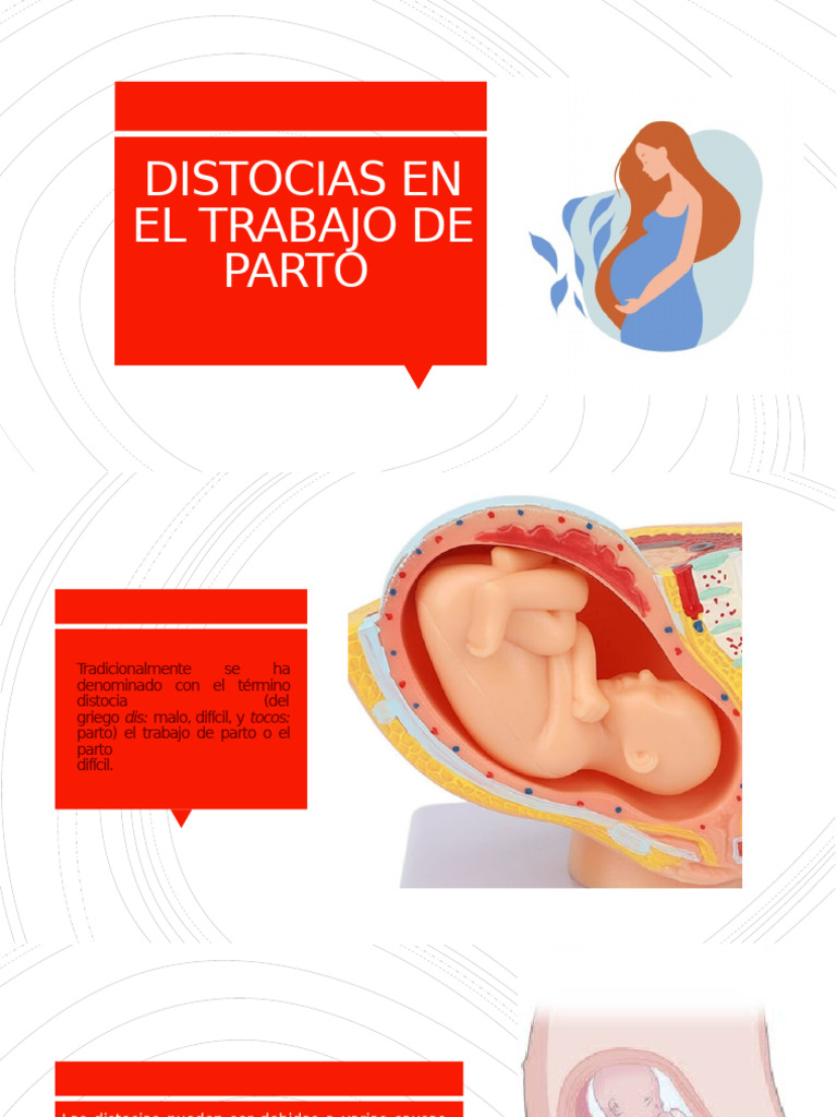 Distocias en El Trabajo de Parto | PDF | Pelvis | Parto