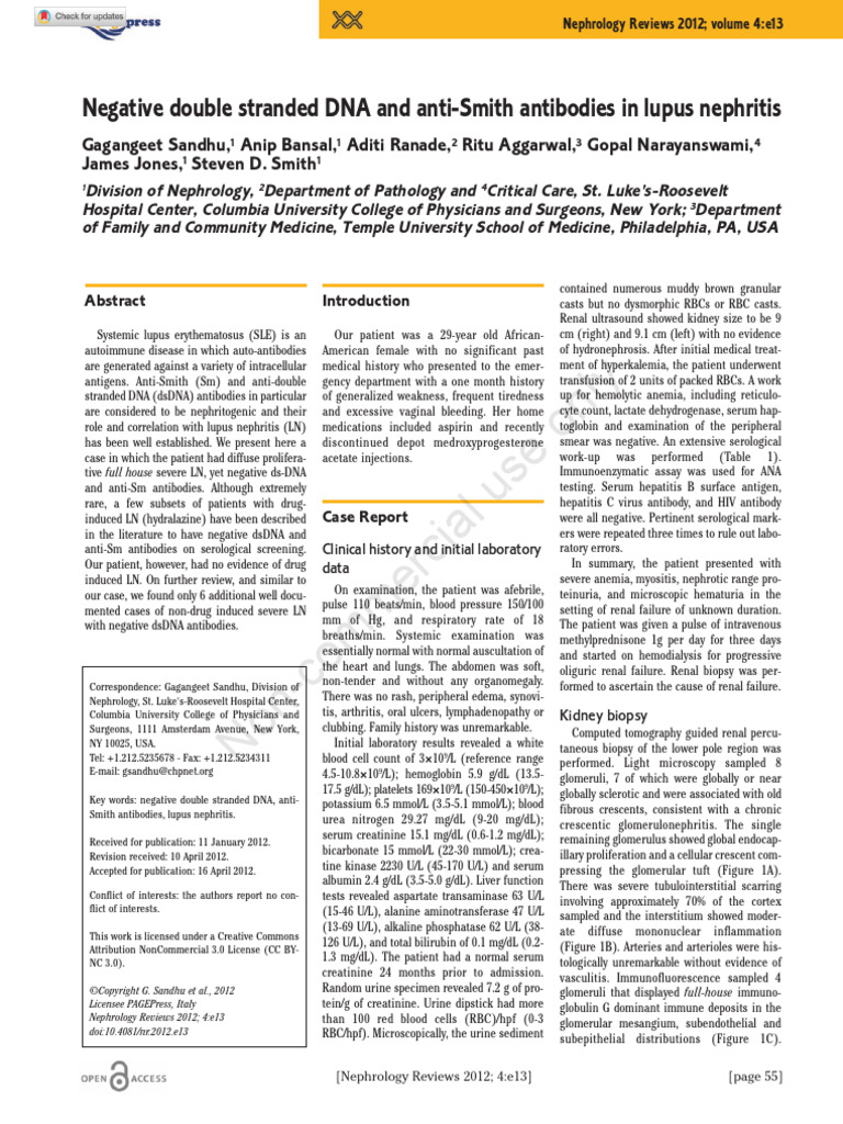 Sandhu Et Al 2014 Negative Double Stranded Dna and Anti Smith ...
