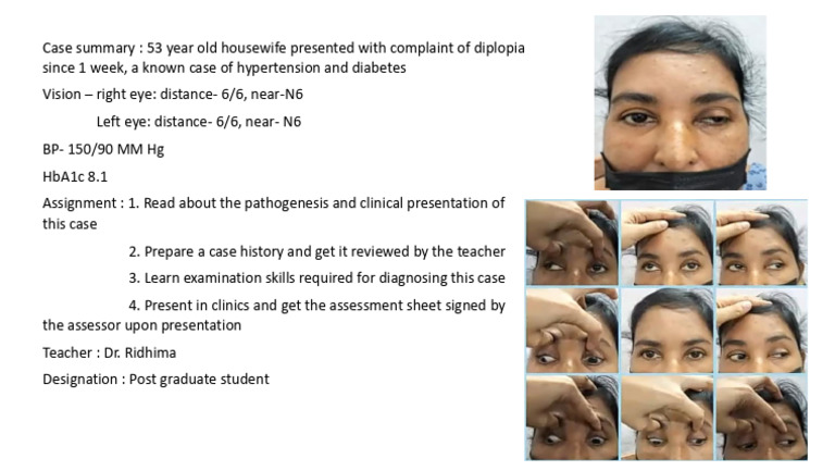 Paralytic Squint Case | PDF