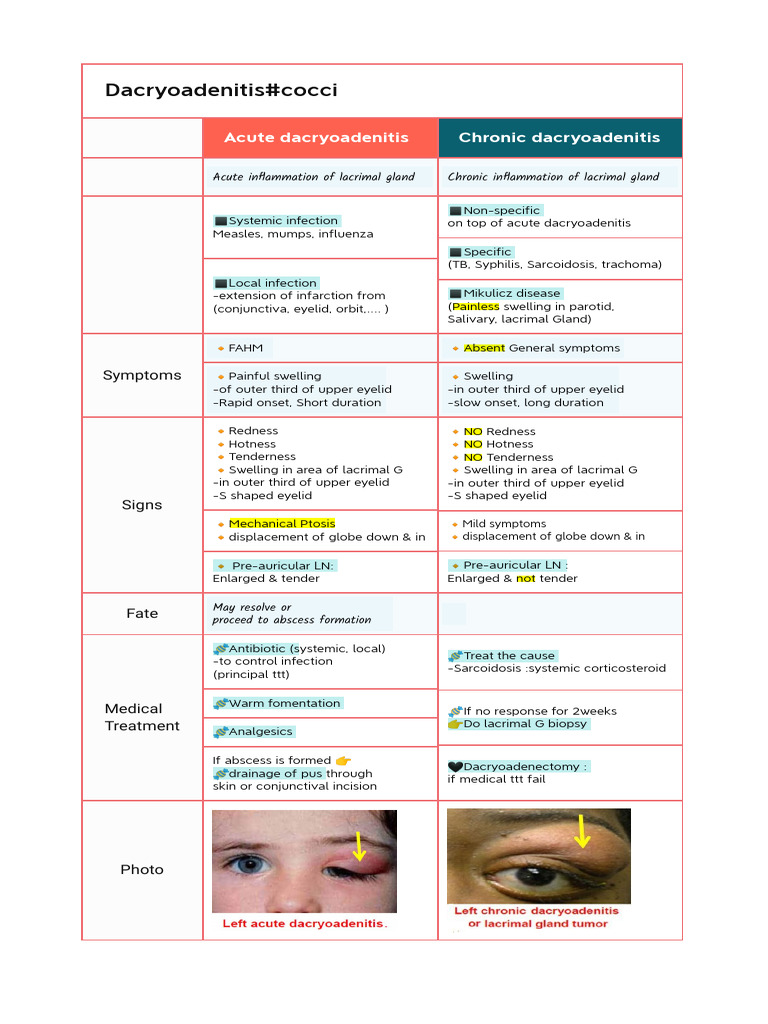 Dacryoadenitis #Cocci | PDF | Medicine | Immunology
