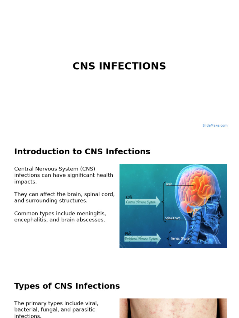 Cns Infections | PDF | Meningitis | Infection