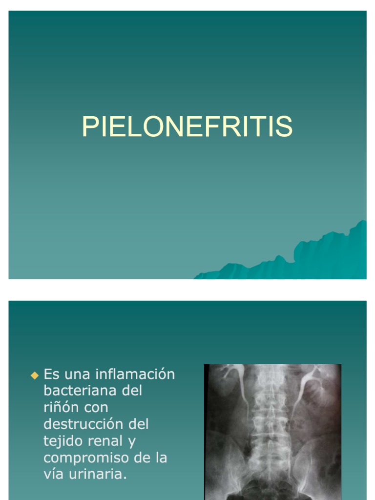 Pielonefritis | PDF | Sistema urinario | Especialidades Medicas