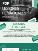 Características Radiográficas de Las Lesiones Periapicales 2020 | PDF ...