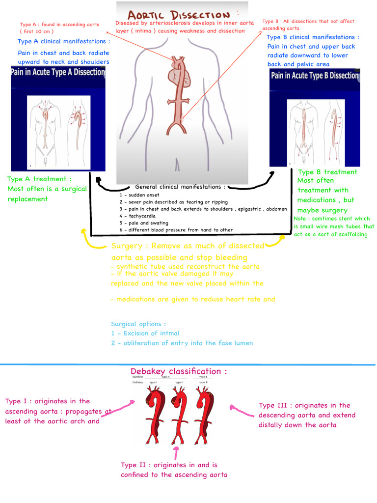 Aorta Dissection Mind Map | PDF | Aorta | Medical Specialties