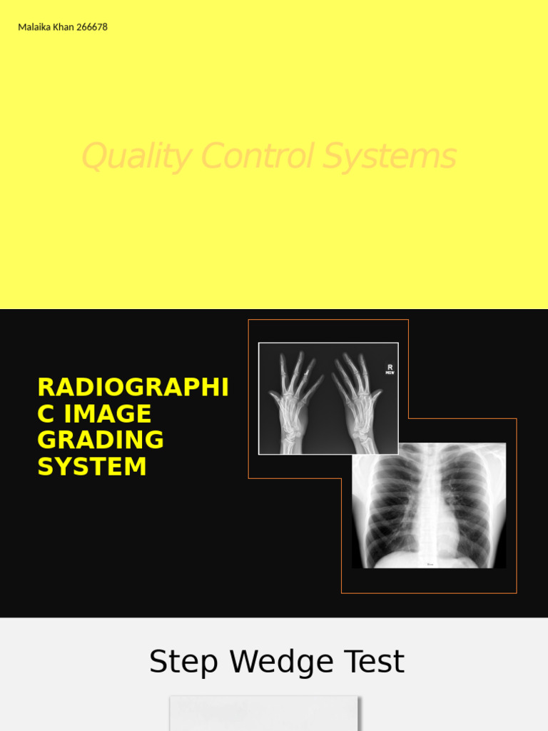 Alara and Alarp | PDF