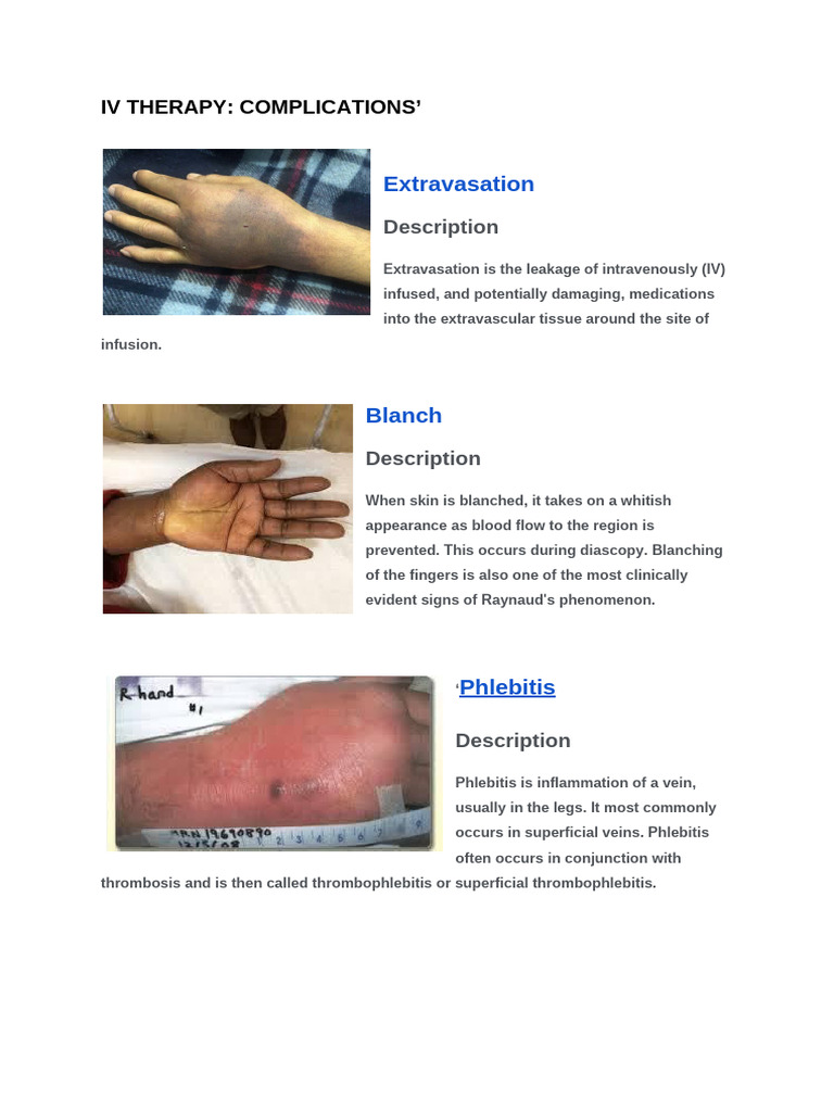 IV Therapy Complications Guide | PDF | Intravenous Therapy | Vein