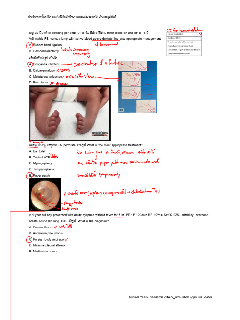ข้อสอบ NL2 รอบ 1 2566 + เฉลย | PDF