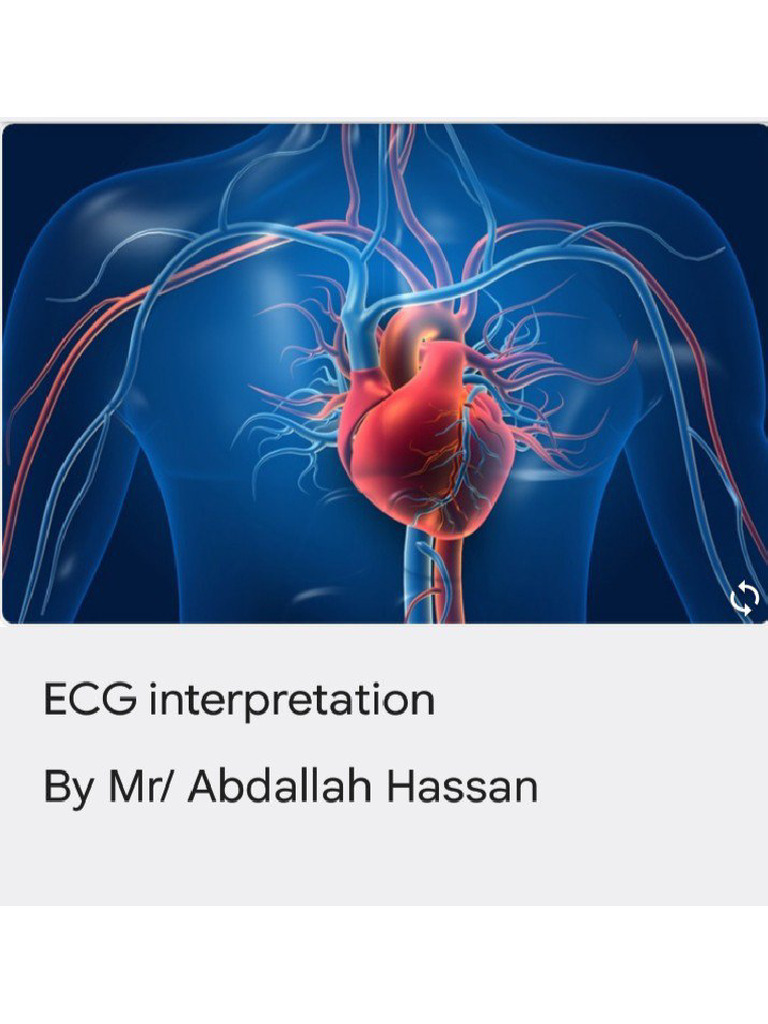 ECG Interpretation Lecture by MR Abdallah Hassan | PDF