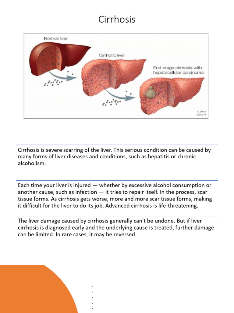 Cirrhosis | PDF | Cirrhosis | Liver