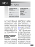 Atrial Fibrillation:Flutter in Pre-Excitation - LITFL - ECG Library ...