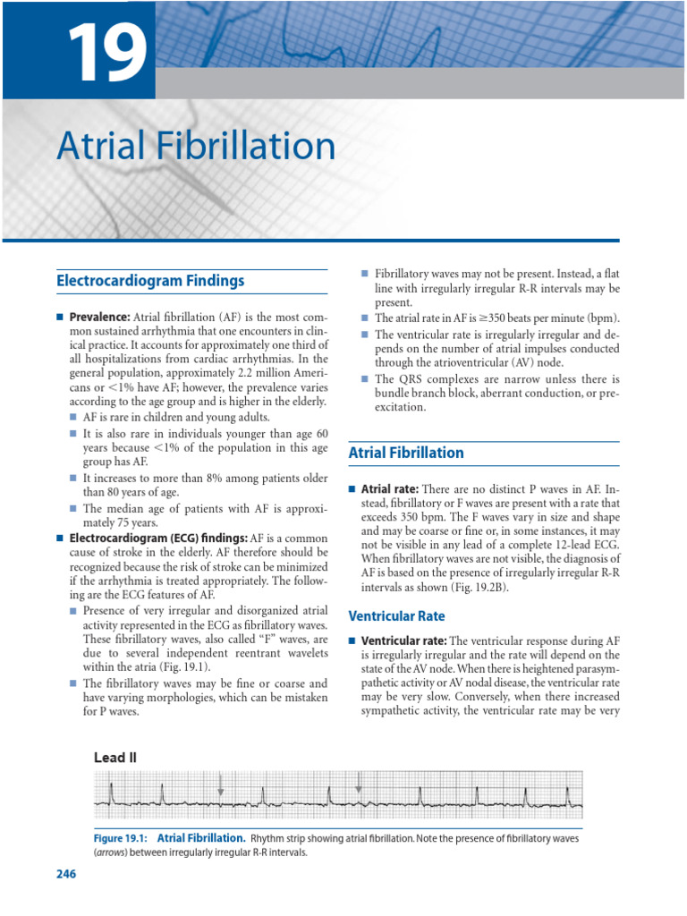 Atrial Fibrillation - Basic and Bedside ECG | PDF | Electrocardiography ...