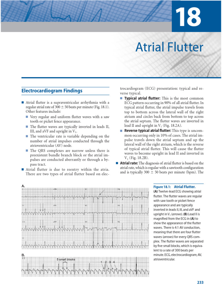 Atrial Flutter - Basic and Bedside ECG | PDF | Electrocardiography ...