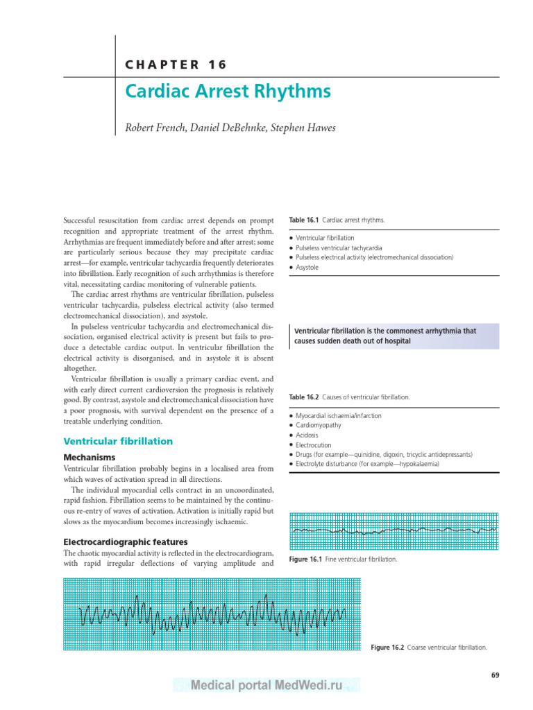Cardiac Arrest Rhythm - ABC of Clinical Electrocardiography 2nd | PDF ...
