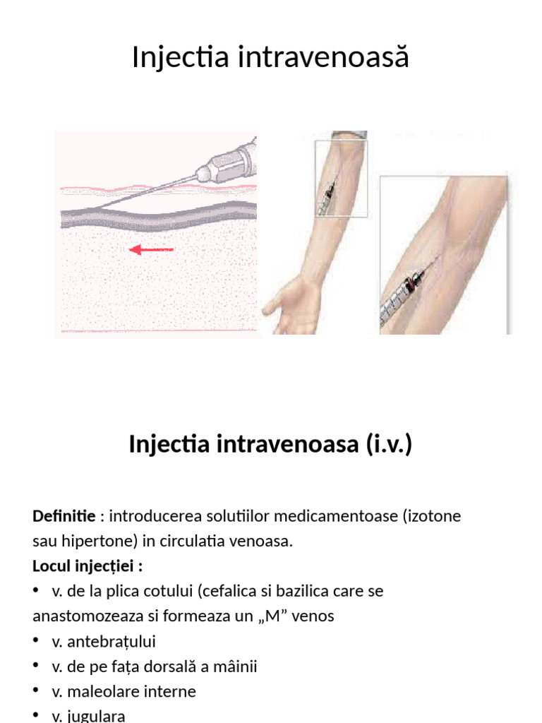 Injectia Intravenoasa | PDF