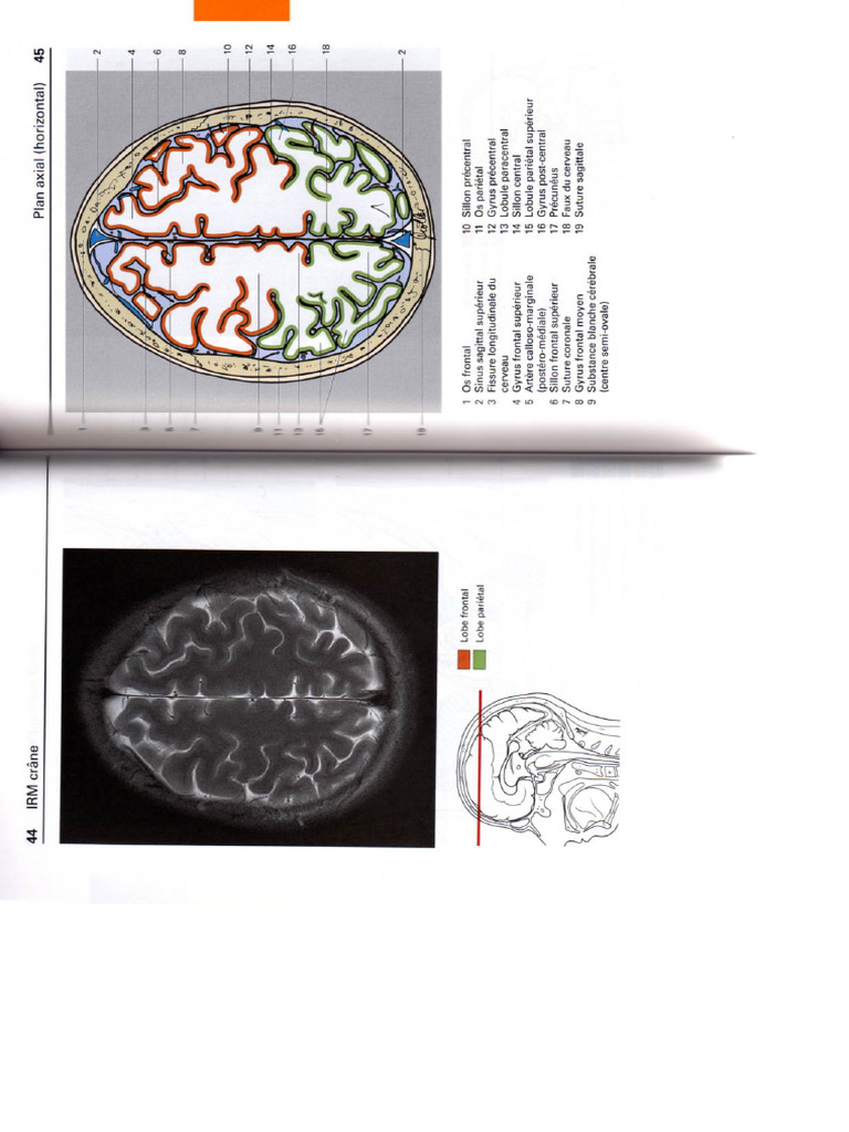 Anat Irm Cerebrale | PDF