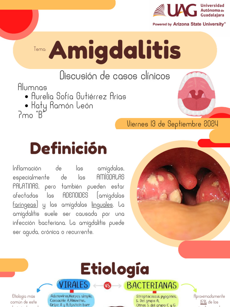 Amigdalitis | PDF | Epidemiología | Inmunología