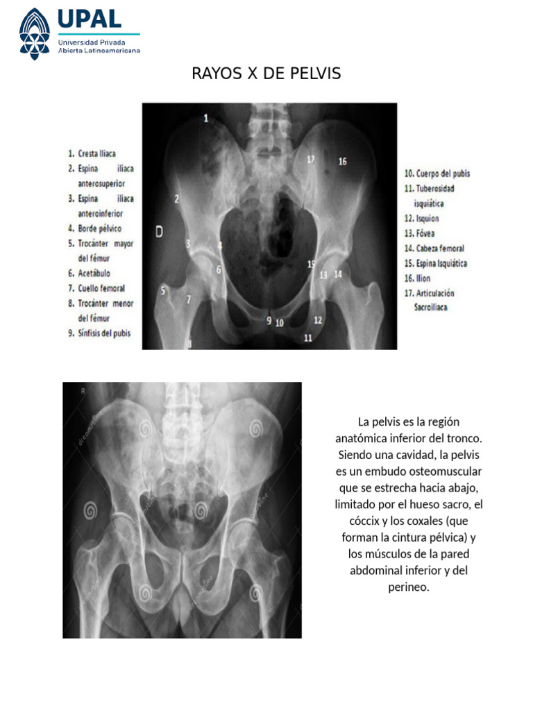 Rayos X de Pelvis | PDF | Ciencias sociales | Historia