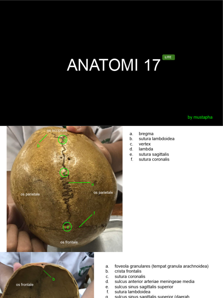 Ospe Anat b17 Cranium (Lite) | PDF | Anatomía humana | Cabeza y cuello humanos