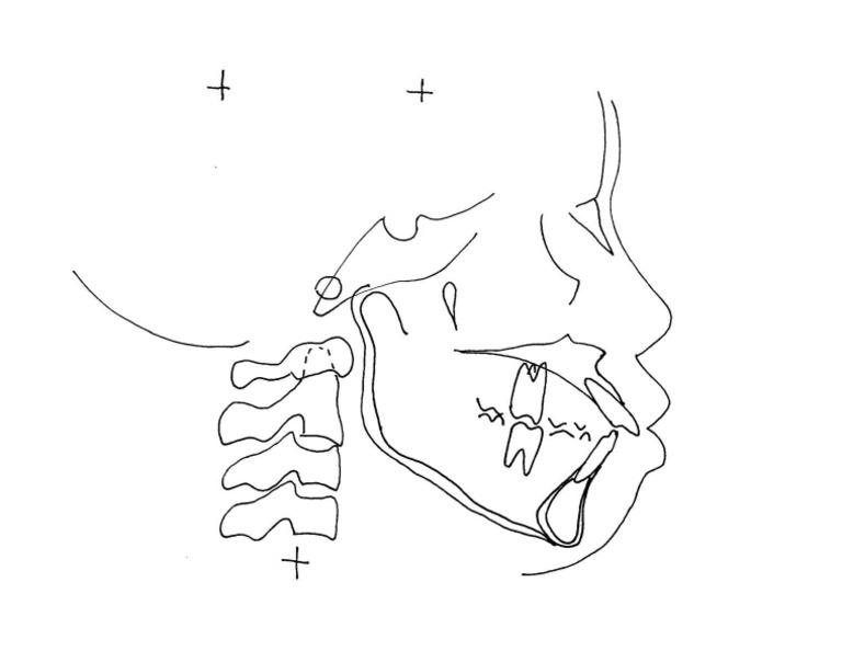SD Ceph Tracing | PDF