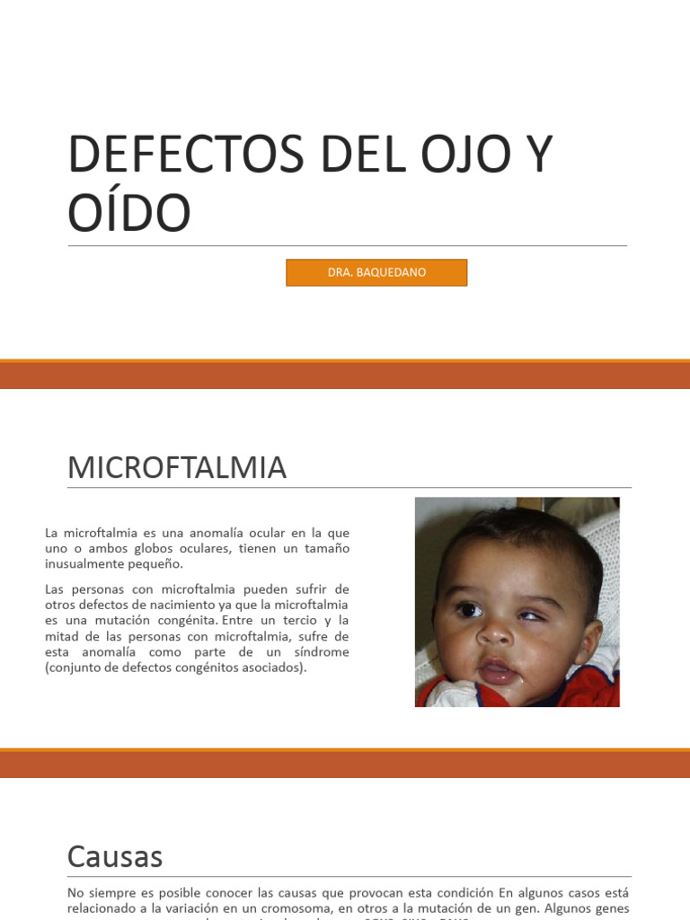 10 Defectos Del Ojo y Oído | PDF | Glaucoma | Ojo humano