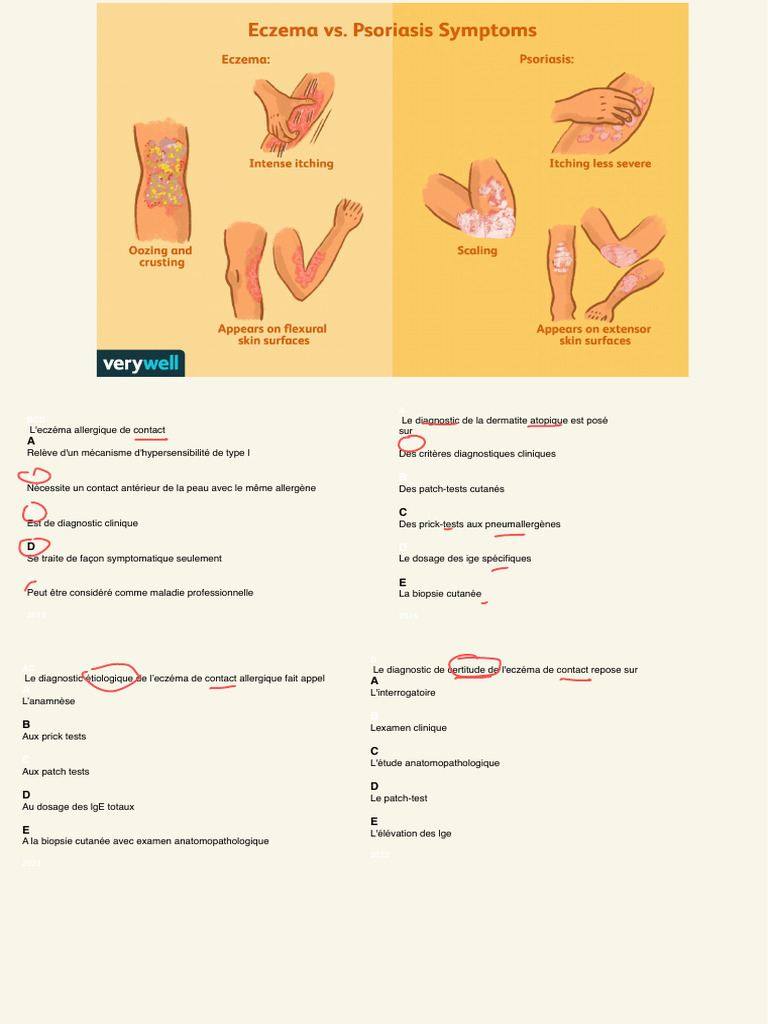 Diagnostic et traitement de l'eczéma | PDF | Spécialités médicales ...
