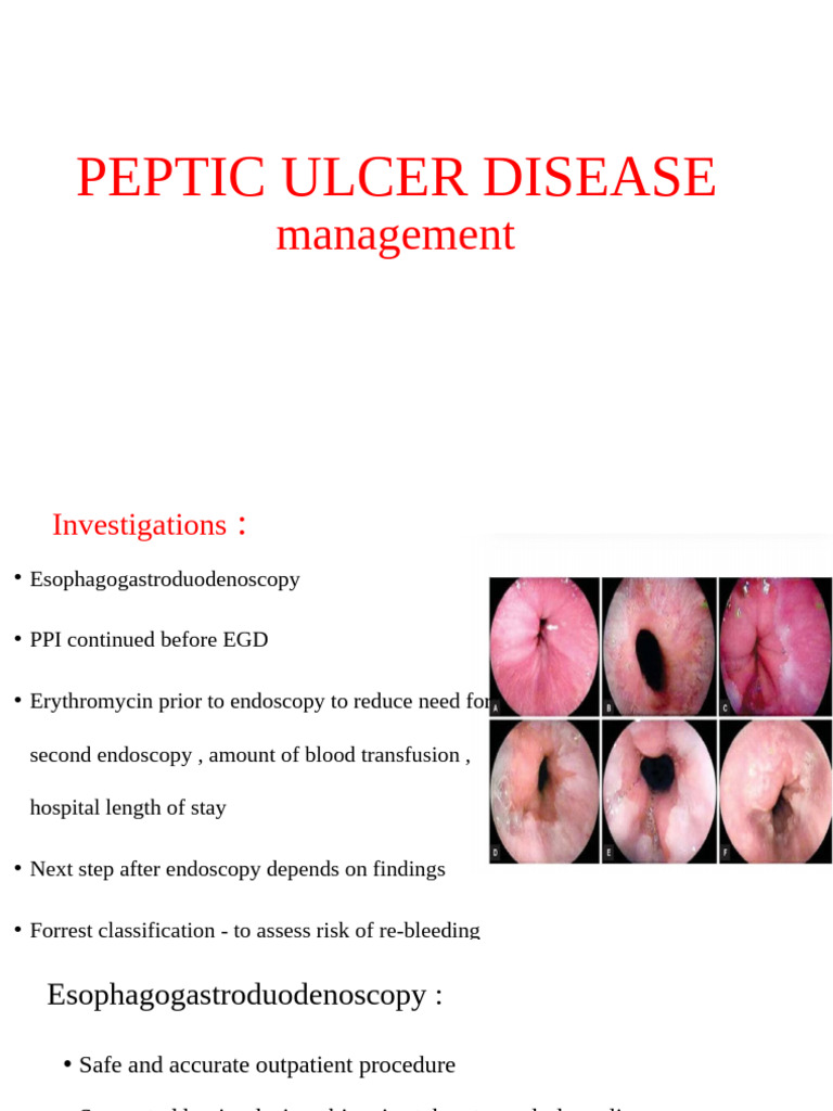 Peptic Ulcer Disease Management | PDF | Digestive System | Gastroenterology