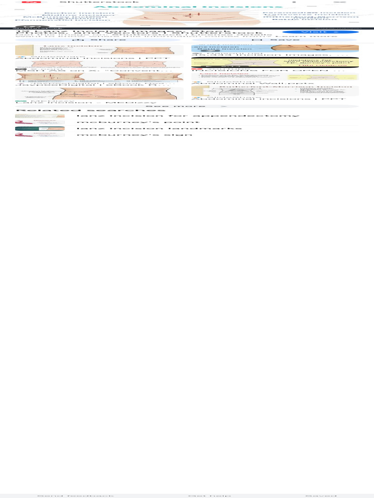 Lanz Incision Overview for Appendectomy | PDF