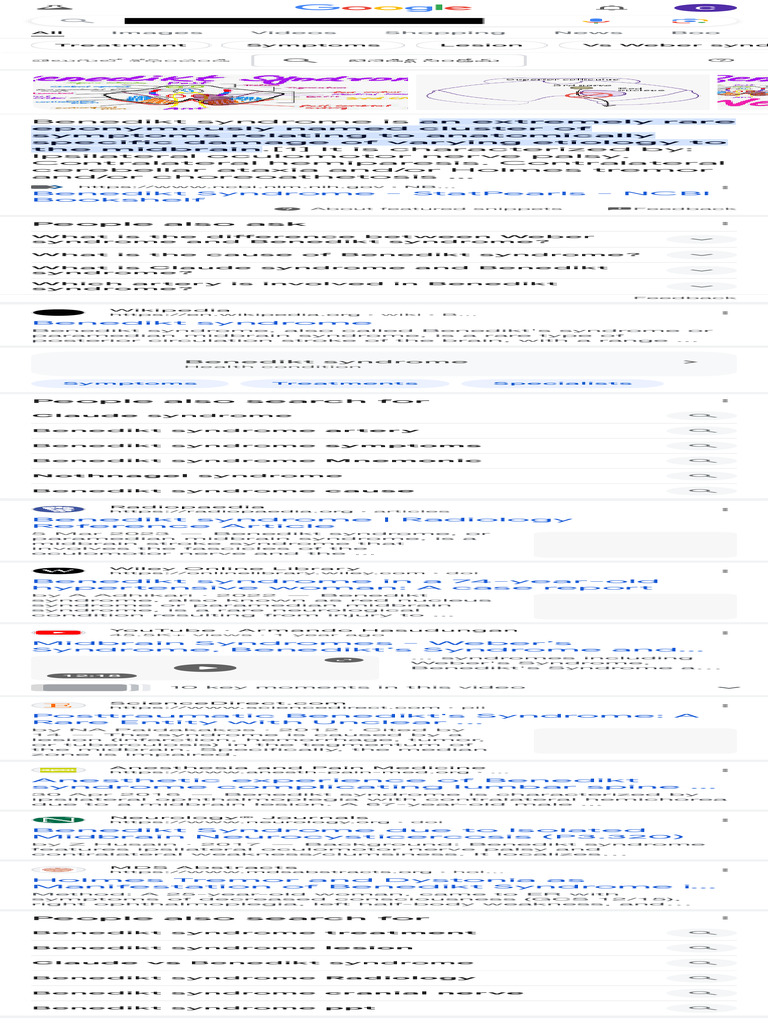 Benedikt Syndrome - Google Search | PDF | Syndrome | Diseases And Disorders