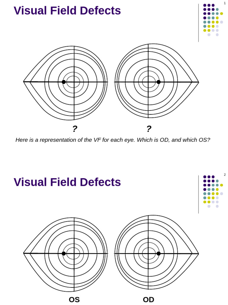 Visual Field Defect | PDF | Retina | Eye