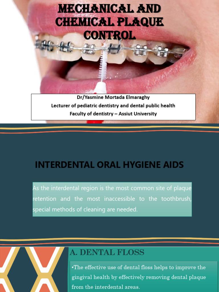Interdental Aids.pdf | PDF | Oral Hygiene | Mouth