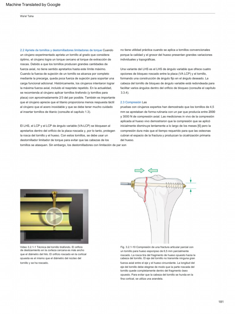AO Principles of Fracture Management 3rd Edition - Booksmedicos - Org ...