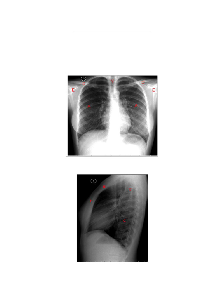 Anatomia Do Tórax Por Imagem - Radiologia | PDF | Pulmão | Coração