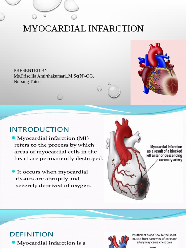 Myocardial Infarction Management Guide | PDF