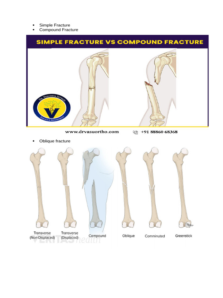 Different Type of Fractures | PDF