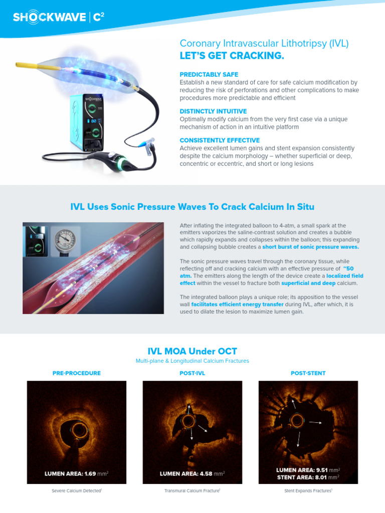 Shockwave Coronary-C2-Tech-Sheet | PDF | Myocardial Infarction | Stent