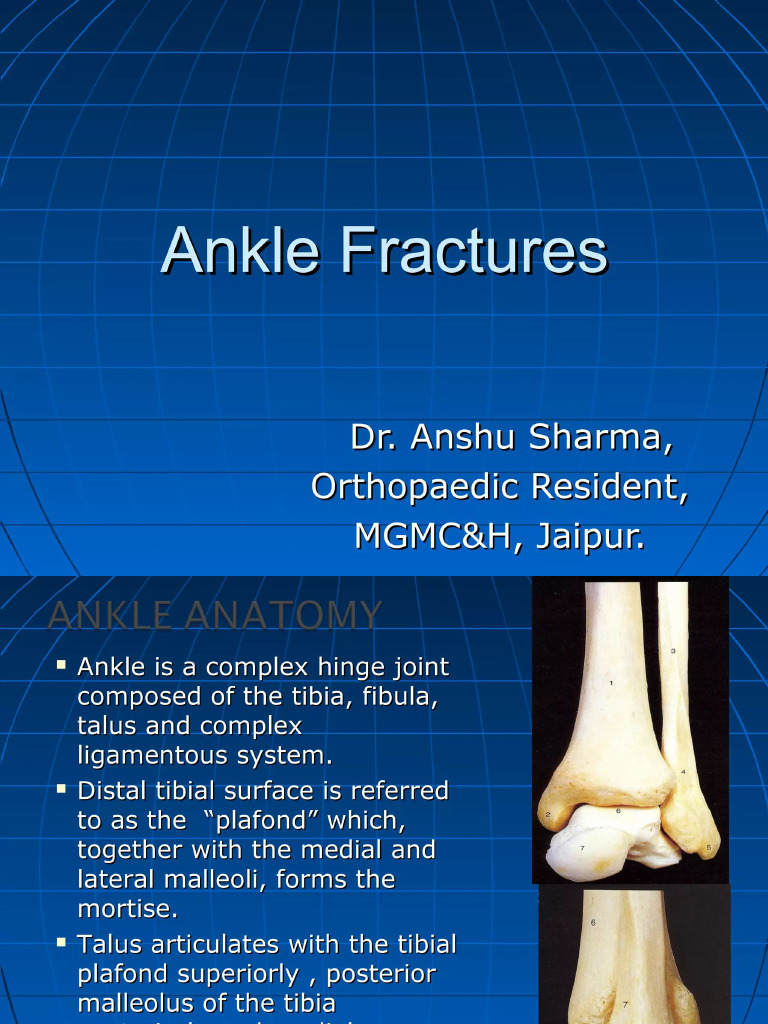 Ankle Fractures PPT | PDF