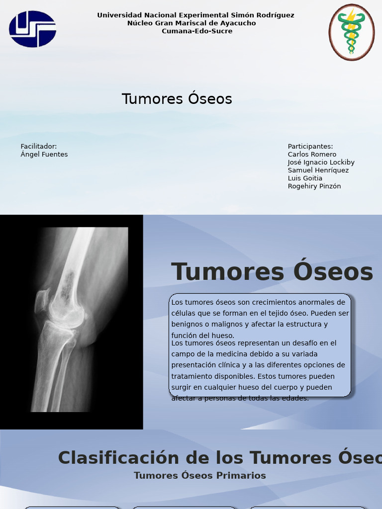 Tumores-Oseos 2 | PDF | Cáncer | Hueso
