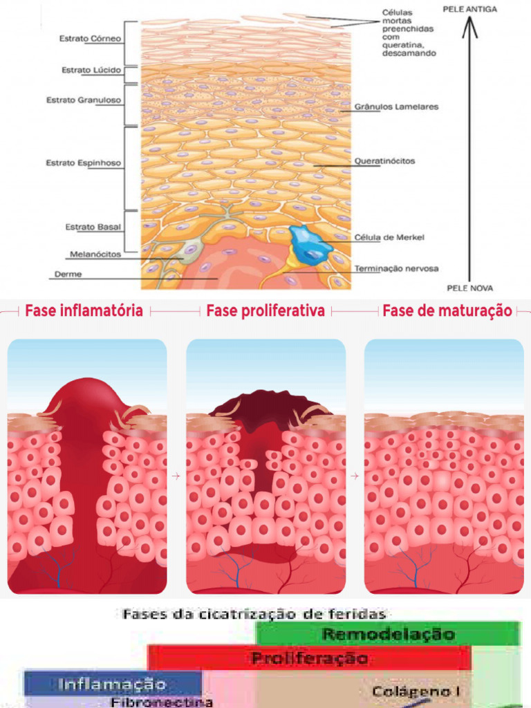 Apresentação Pele e Lesões | PDF | Necrose | Remédio