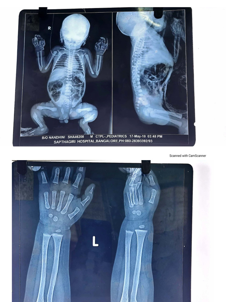 X-Ray and Instruments Pediatrics | PDF