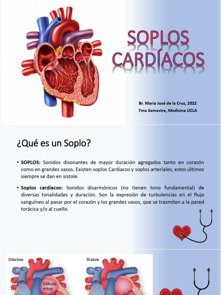 SOPLOS CARDIACOS. Majo | PDF | Corazón | Angiología