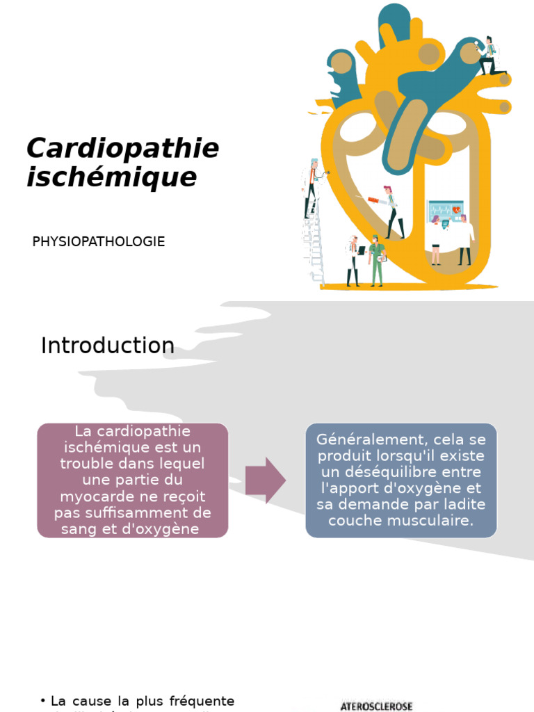 Cardiopathie Ischémique - Physiopathologie | PDF | Infarctus du ...