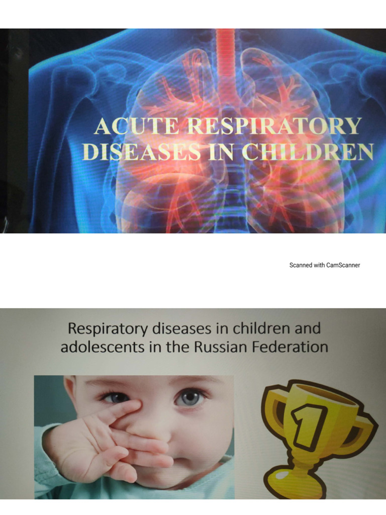 01 Acute Respiratory Disease | PDF