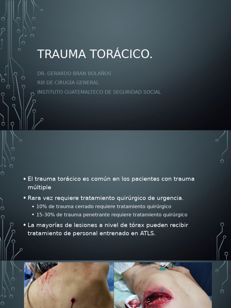 Trauma Toracico Rev | PDF | Emergencias Médicas | Traumatologia
