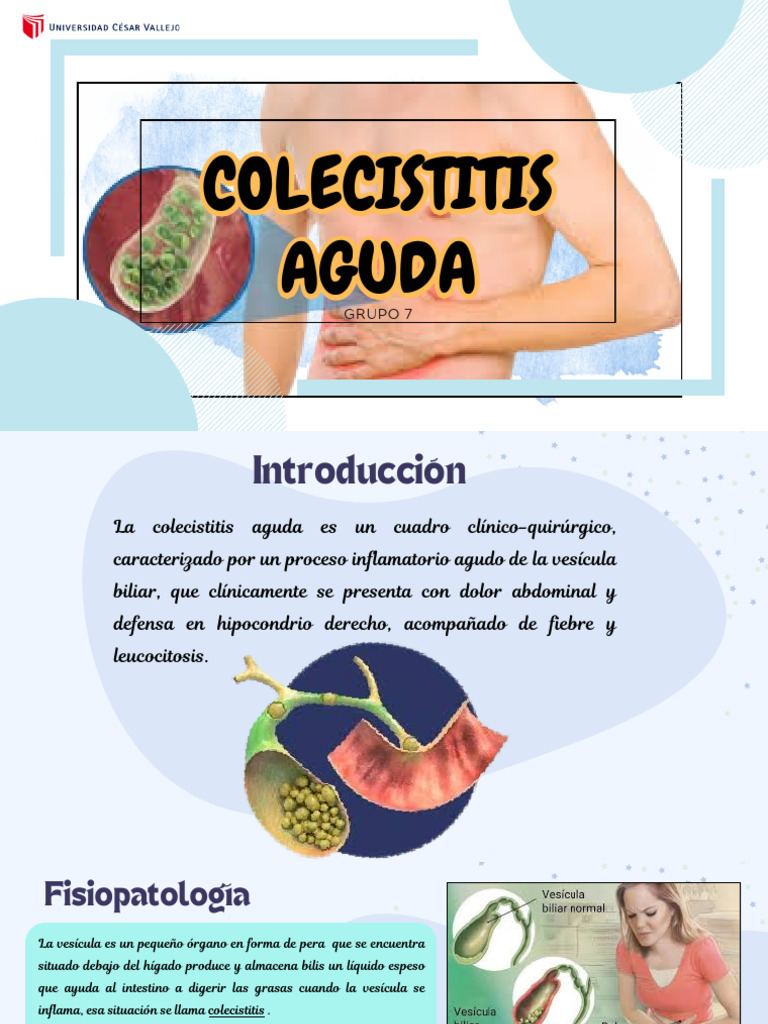 Colesistitis Aguda | PDF | Vesícula biliar | Bilis